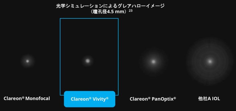 クラレオンビビティ（Clareon Vivity）｜大阪・京都の医療法人 創夢会眼科グループ