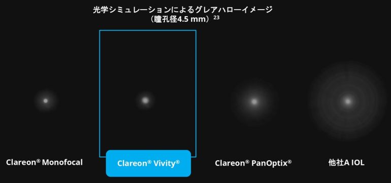 クラレオンビビティ（Clareon Vivity）｜大阪・京都の医療法人 創夢会眼科グループ